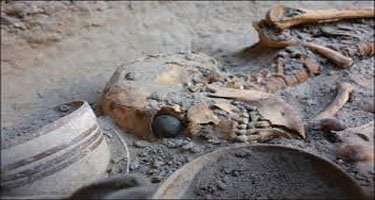 The world’s first prosthetic eye – History Bytez